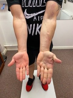 Anthropometric Asymmetry | Biomechanics Academy
